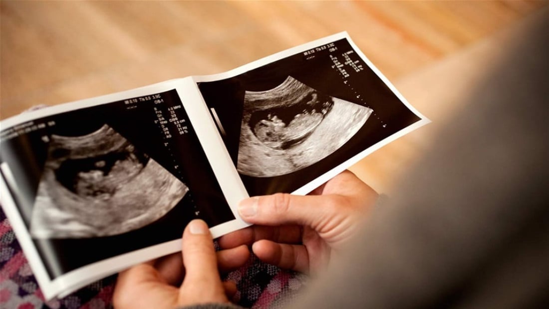 A rare practical case... A 9-year-old fossilized fetus causes the death ...